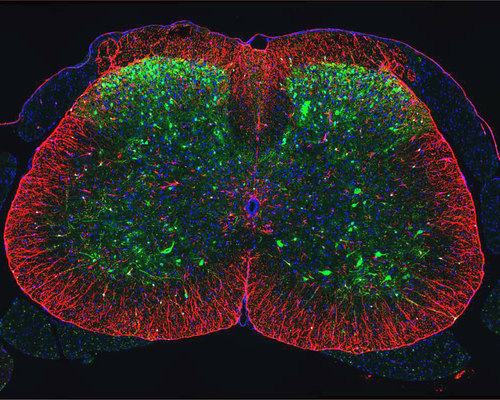 细菌注射系统在小鼠和人类细胞中传递蛋白质| Broad研究所188金宝搏官网手机版 - 188金宝搏官网登录app,188金宝搏官网手机版
